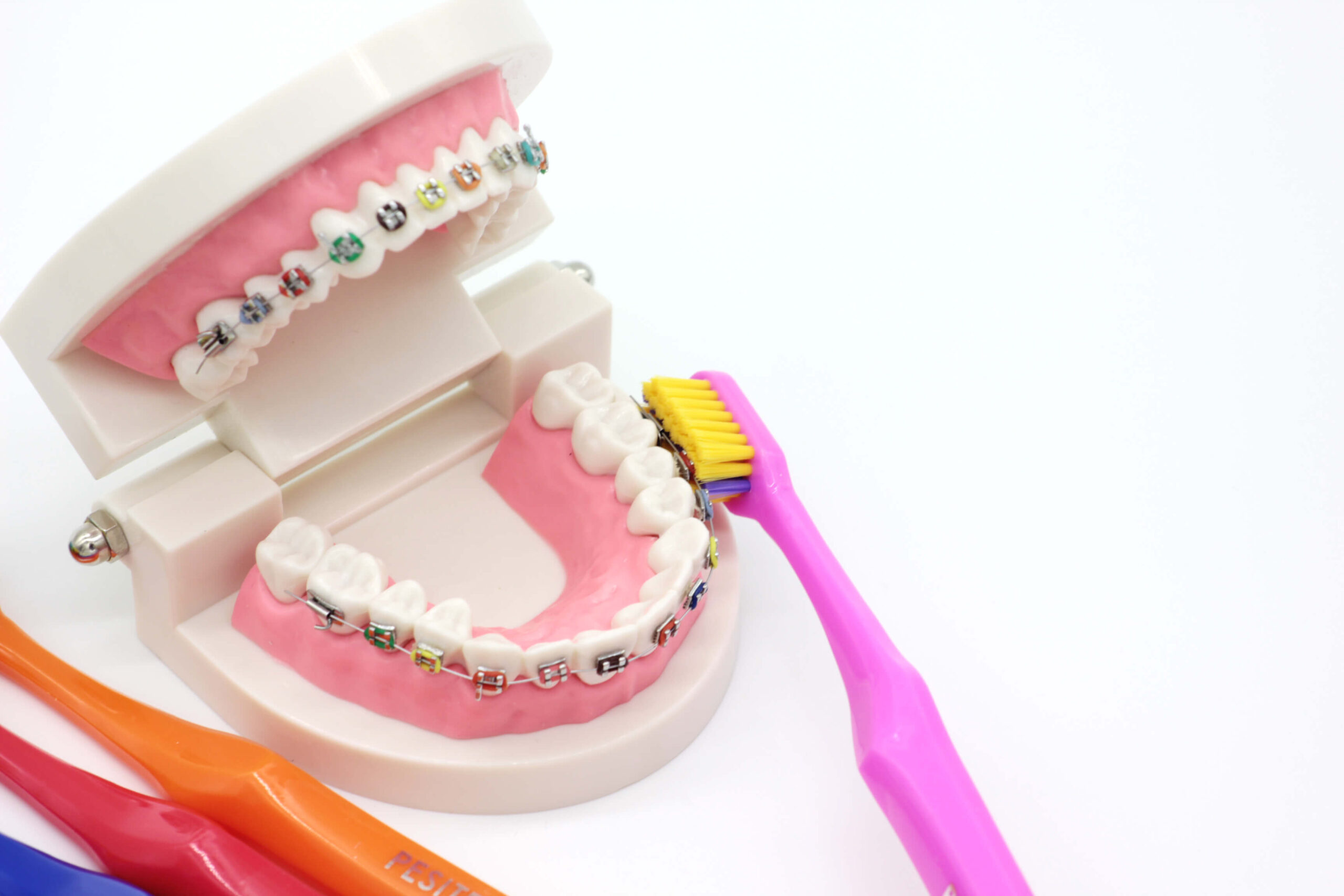 Bàn chải răng niềng Pesitro Ultra Soft Ortho 6580 - 2Teco